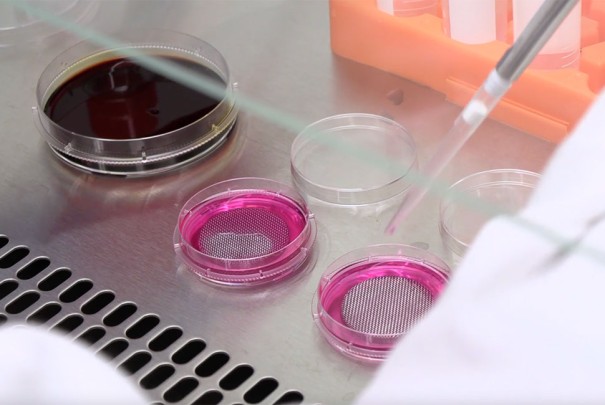 ‘Super melanin’ heals skin injuries from sunburn, chemical burns ...