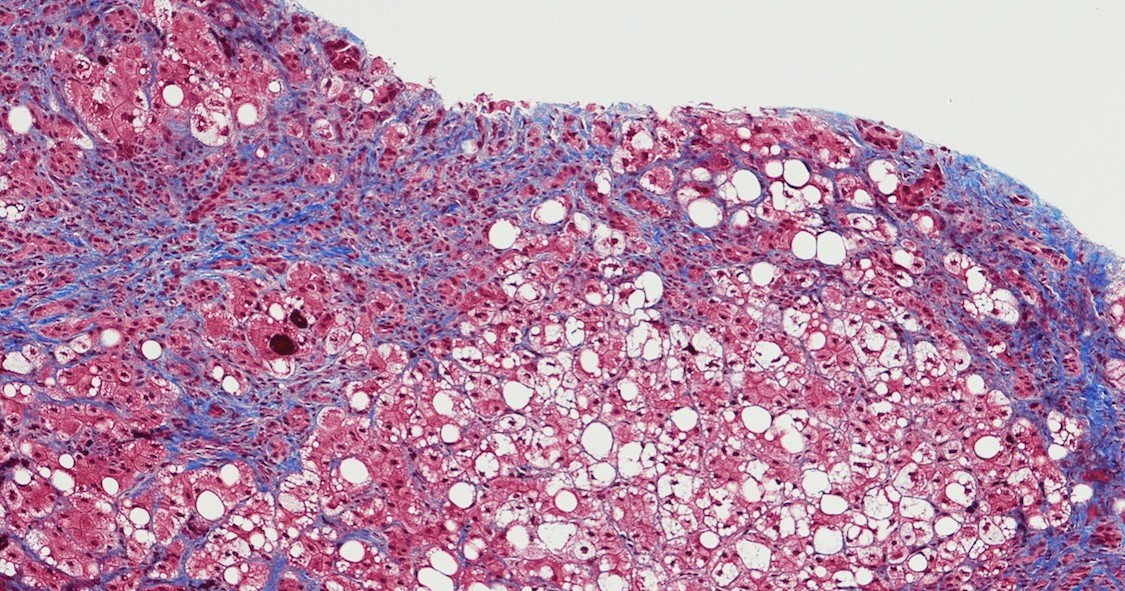 Why internal scars won’t stop growing - Northwestern Now