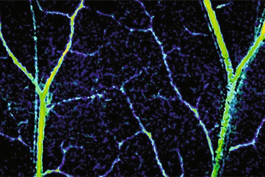 New technology gives unprecedented look inside capillaries ...