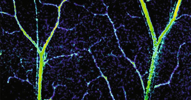 New technology gives unprecedented look inside capillaries ...