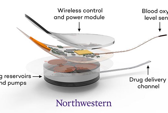 Bioelectronic implant could prevent opioid deaths - Northwestern Now Bioelectronic implant could prevent opioid deaths - Northwestern Now