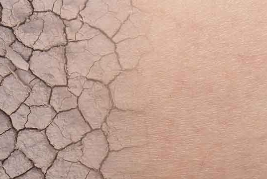 Getting under your skin: Molecular research builds new understanding of ...