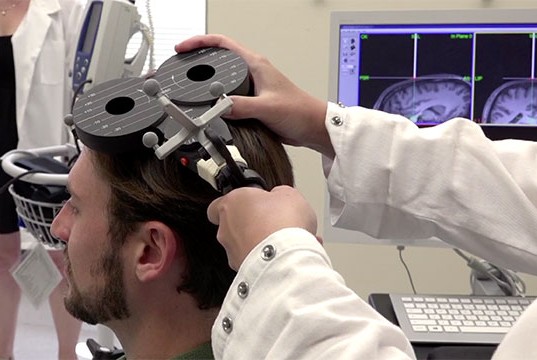 Brain stimulation boosts memory replay, accuracy - Northwestern Now
