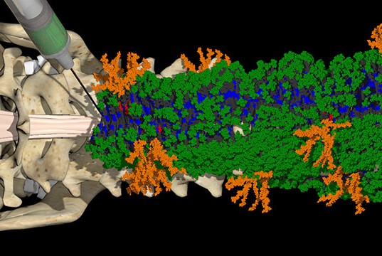‘Dancing molecules’ successfully repair severe spinal cord injuries ...