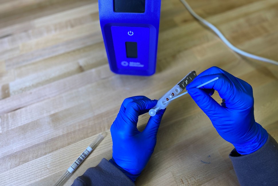 Monkeypox rapid PCR test in development - Northwestern Now