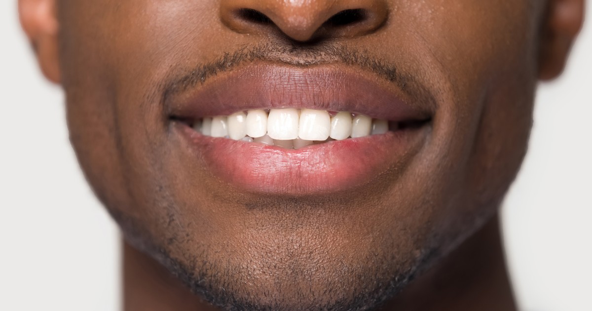 Variety in enamel composition may predict later tooth health ...