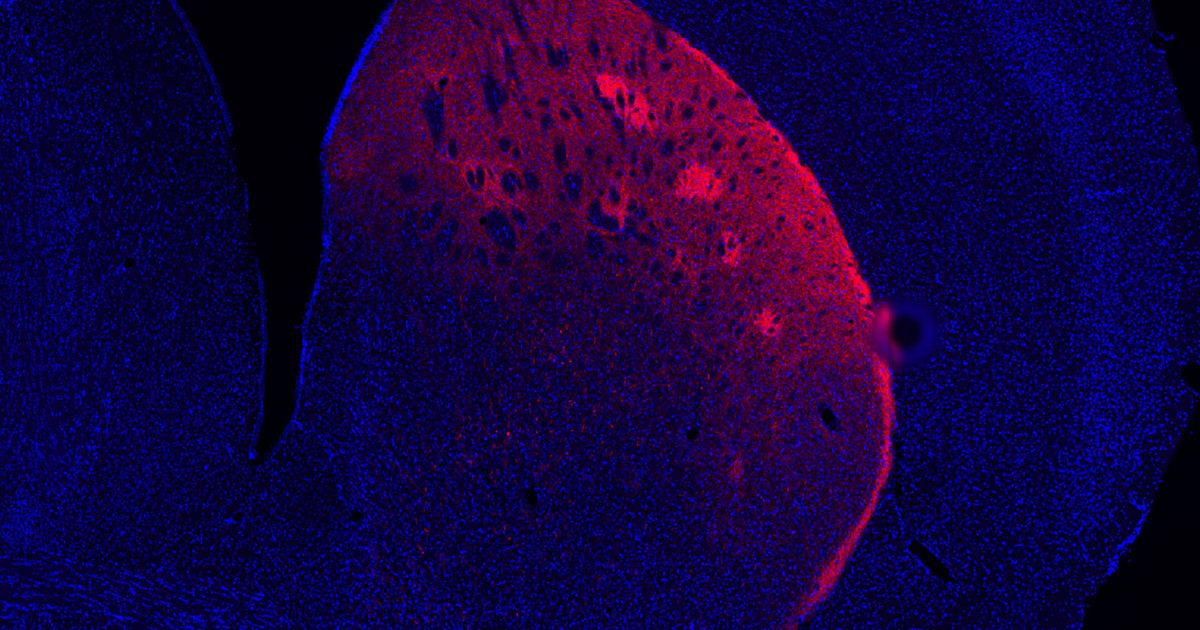 Dopamine controls movement, not just rewards - Northwestern Now