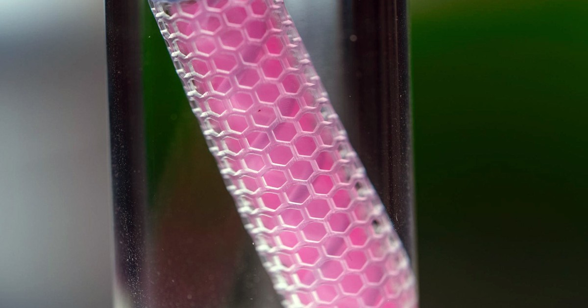 Small, implantable device could sense and treat cancer - Northwestern Now