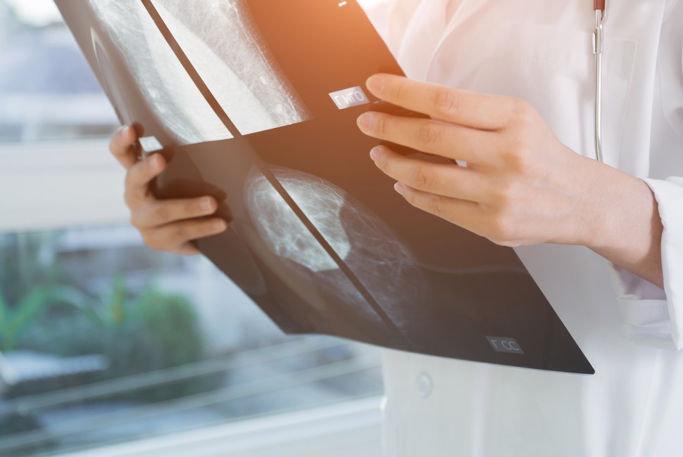 AI may spare breast cancer patients unnecessary treatments ...