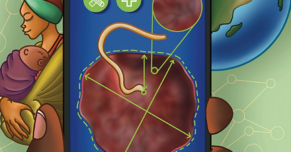 AI Tool Speeds Placenta Analysis for Health Issues | Mirage News